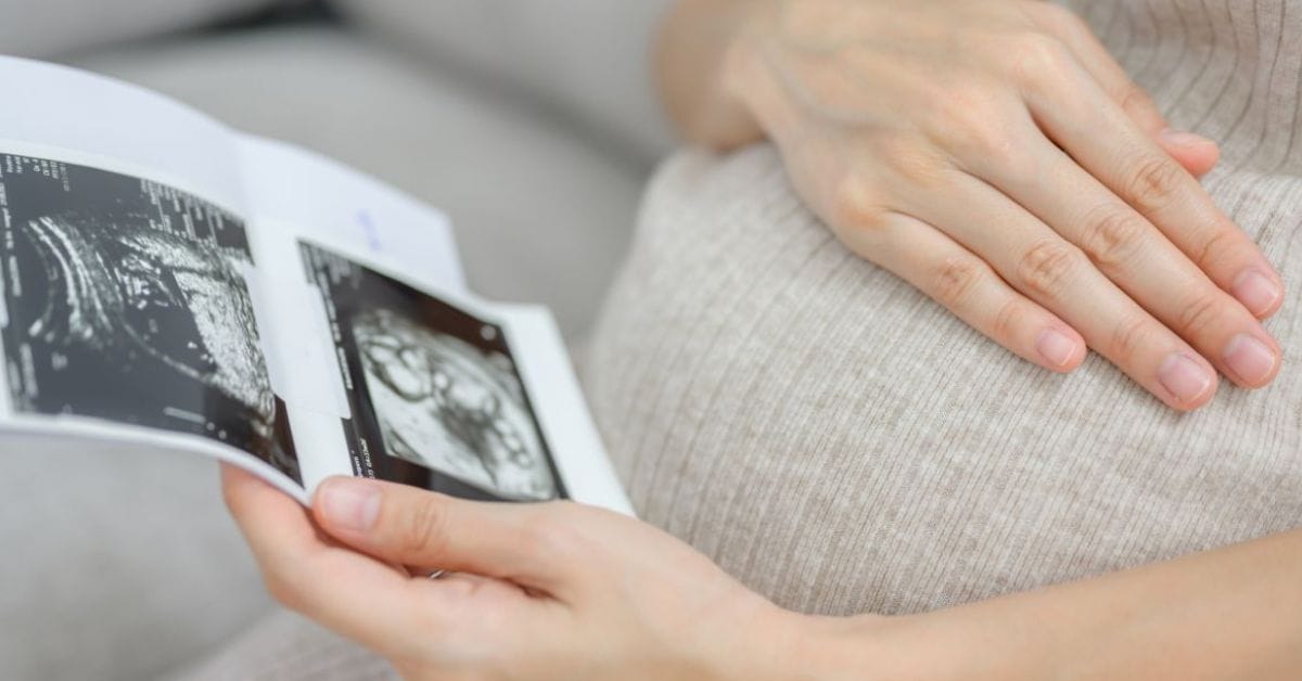 Pre-conception Screening - Sincere Healthcare Group